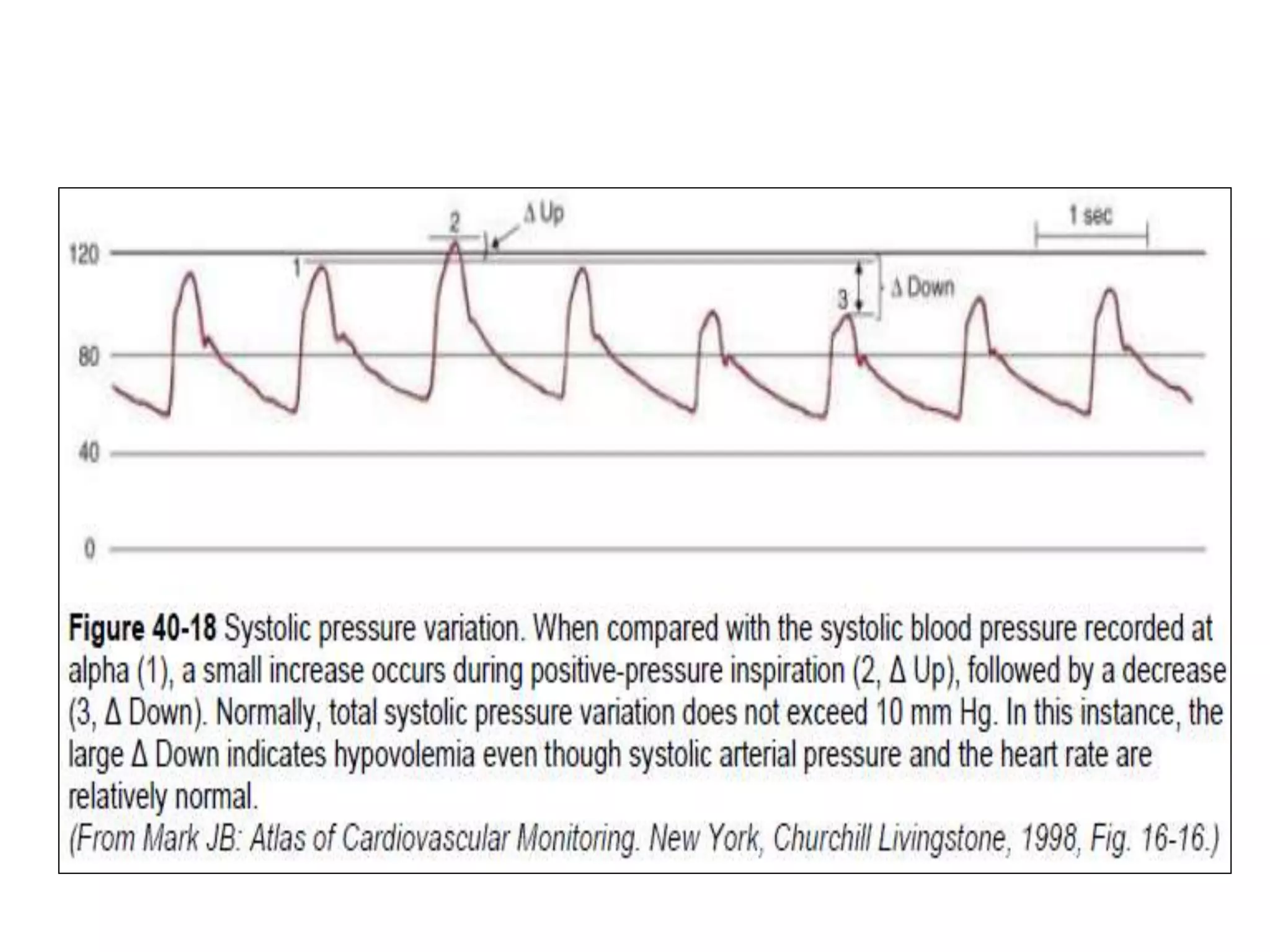 Basic and advanced Cardiovascular monitoring.pptx