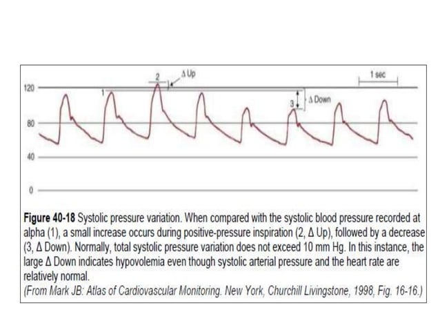 Basic and advanced Cardiovascular monitoring.pptx
