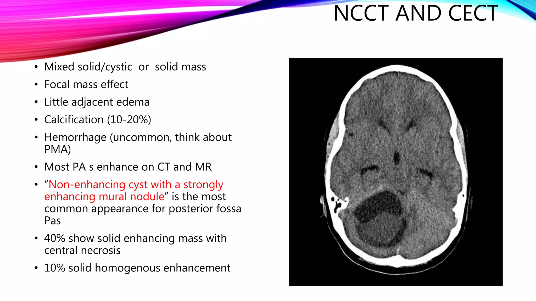Basic and advanced imaging in adult gliomas | PPTX