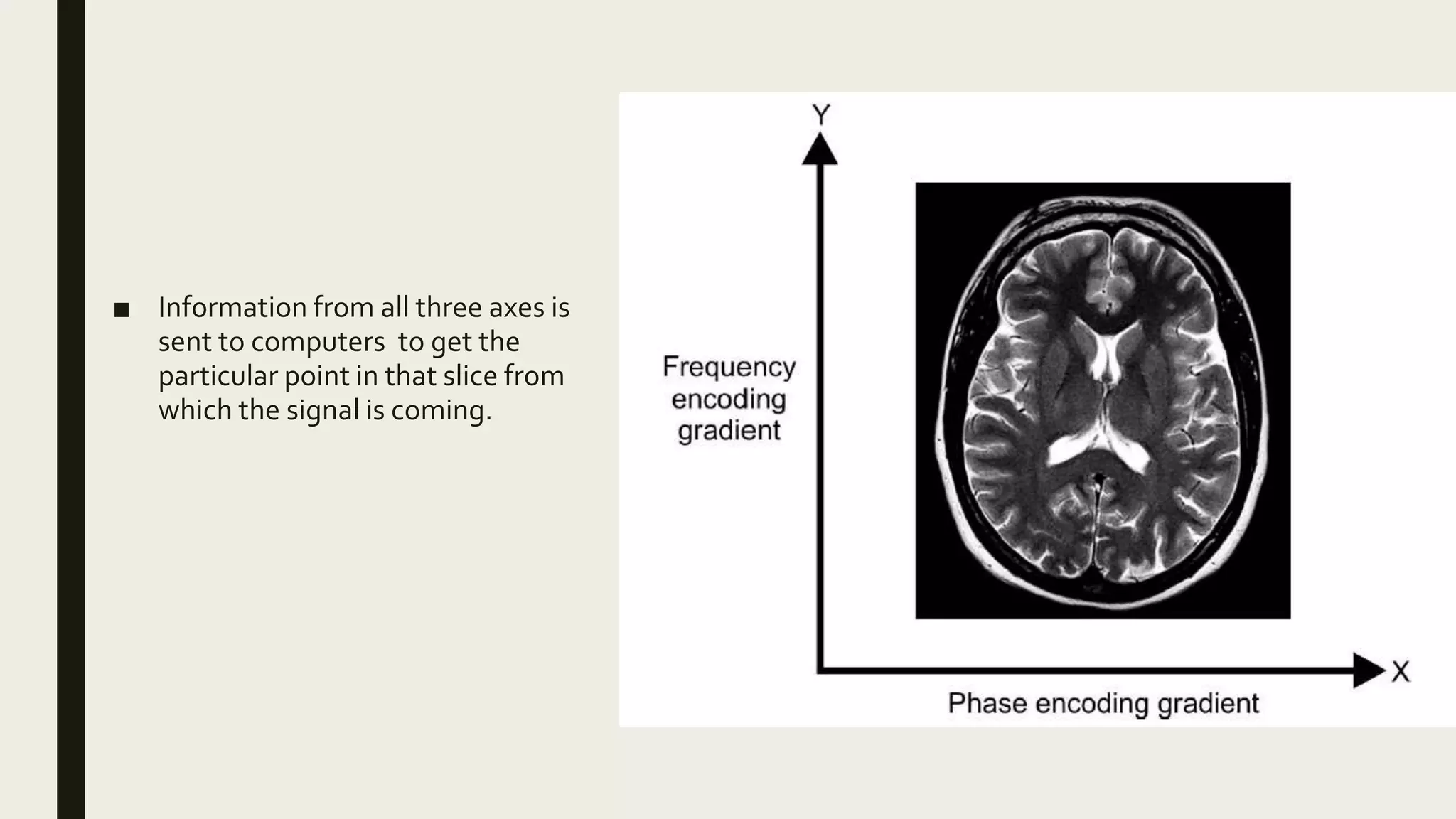 Basic and advanced mri imaging sequences in brain | PPTX