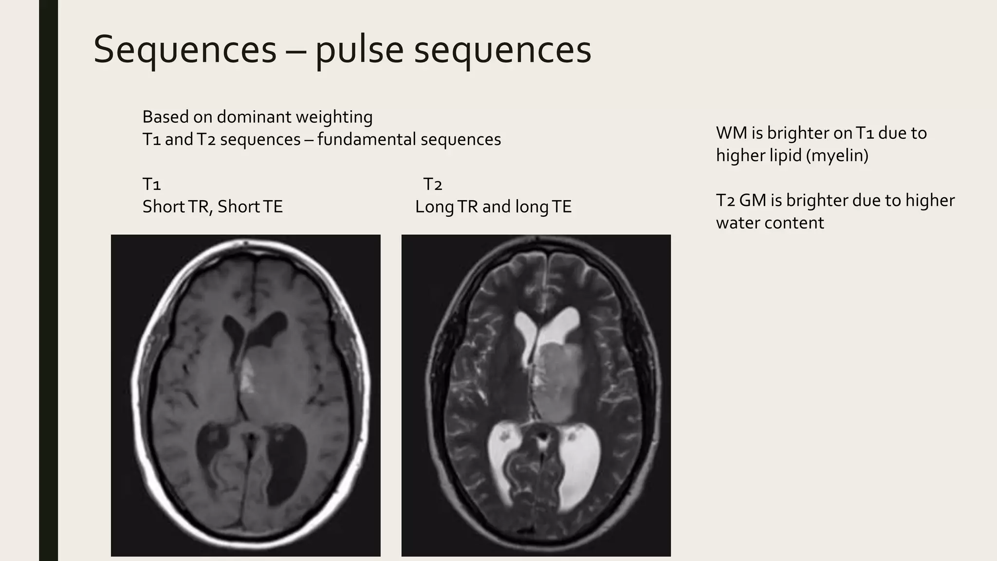 Basic and advanced mri imaging sequences in brain | PPTX