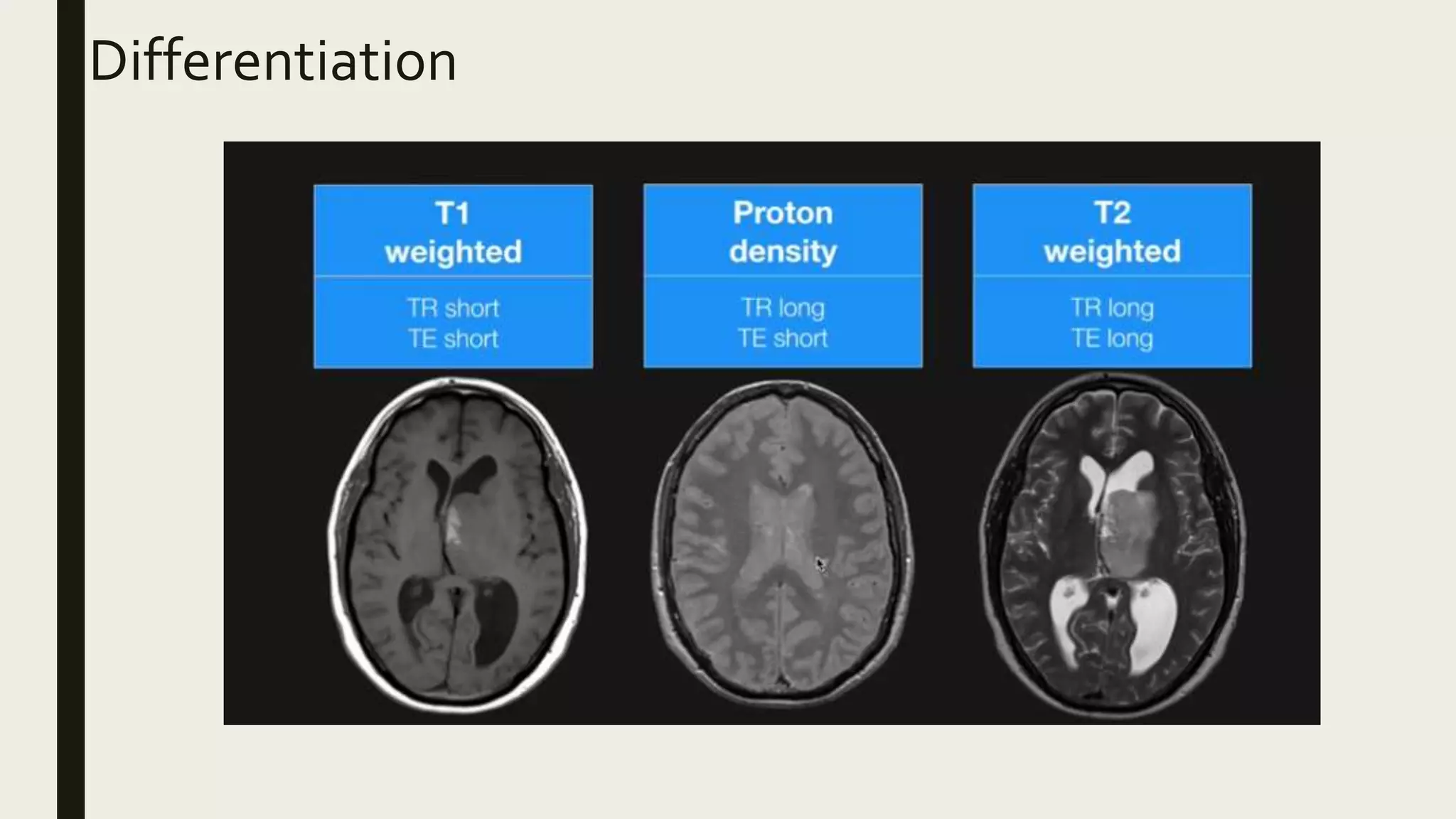 Basic and advanced mri imaging sequences in brain | PPTX