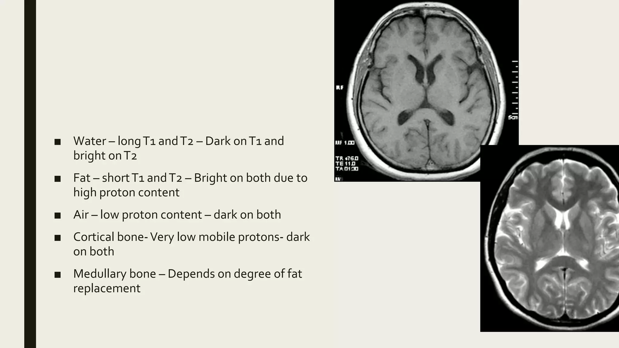 Basic and advanced mri imaging sequences in brain | PPTX