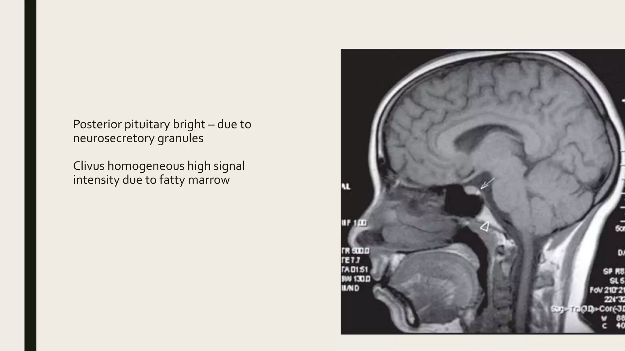 Basic and advanced mri imaging sequences in brain | PPTX