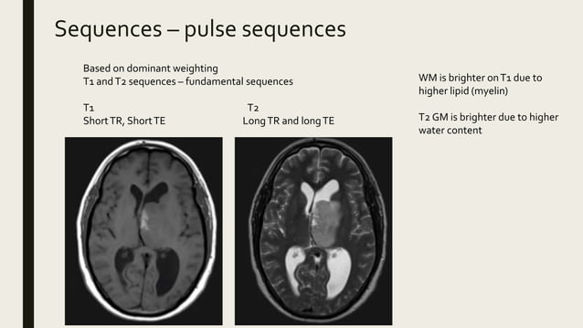 Basic and advanced mri imaging sequences in brain | PPTX