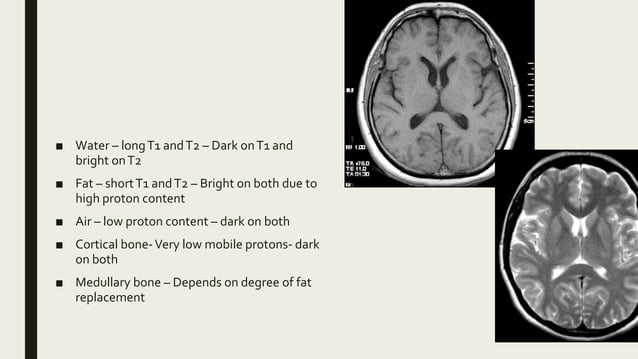 Basic and advanced mri imaging sequences in brain | PPTX