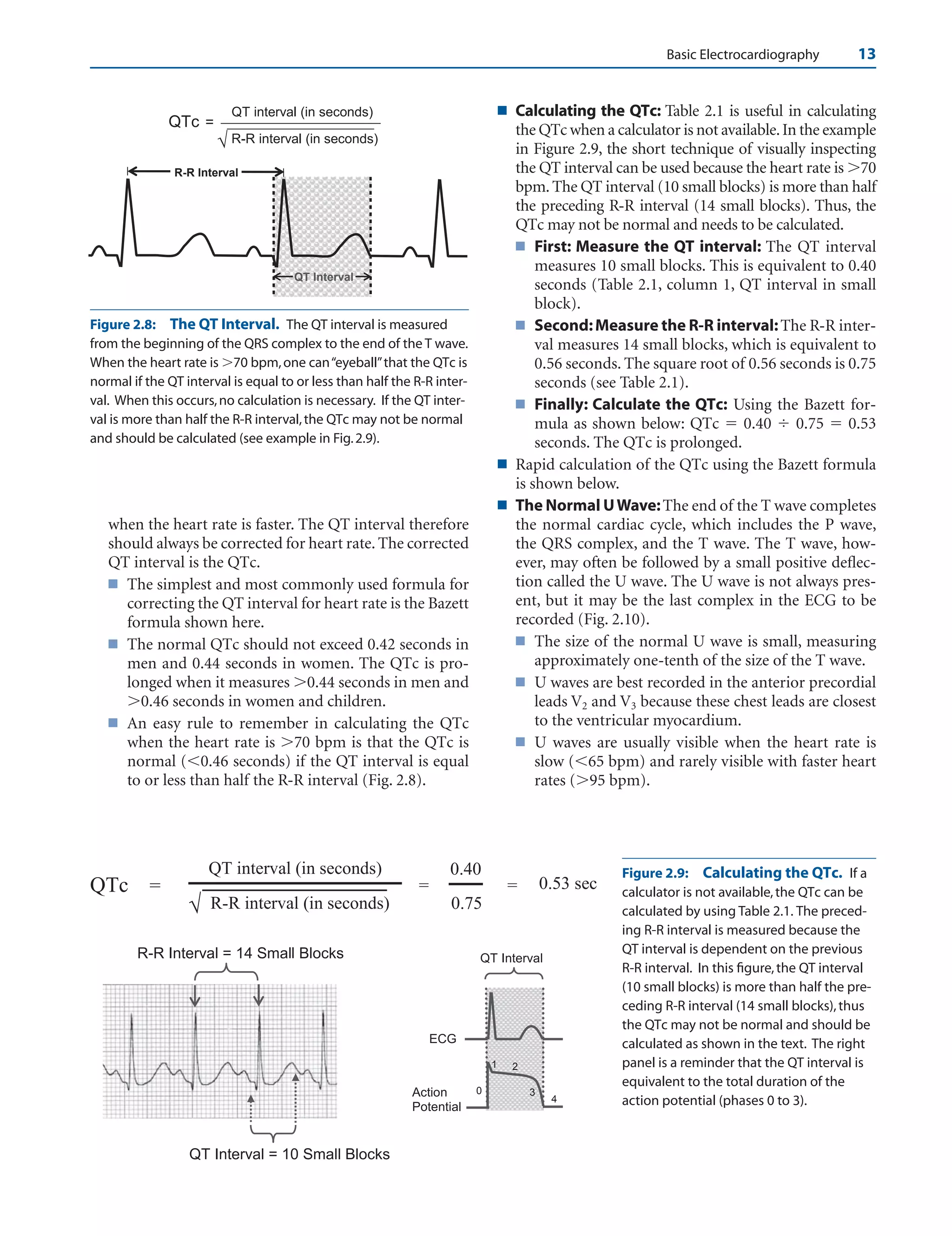 basic and bedside ECG.pdf