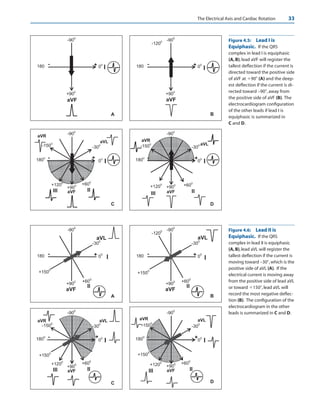 basic and bedside ECG.pdf
