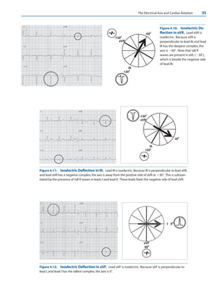 basic and bedside ECG.pdf