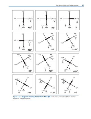 basic and bedside ECG.pdf
