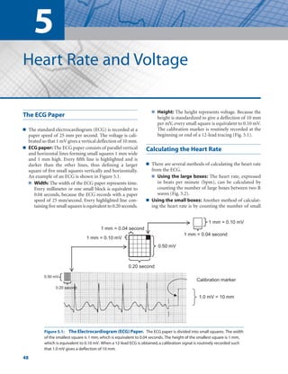 basic and bedside ECG.pdf