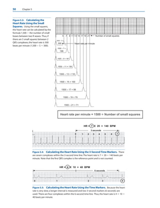 basic and bedside ECG.pdf