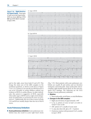 basic and bedside ECG.pdf