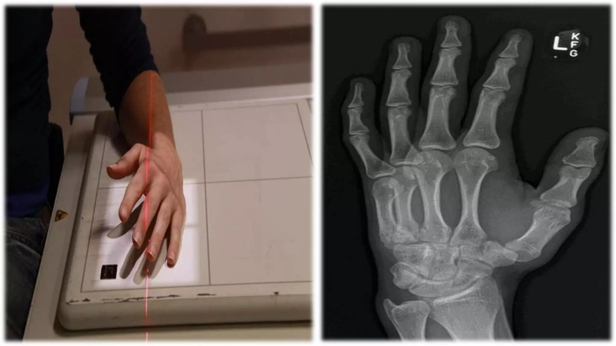 Basic and supplementary projection of hand | PPTX