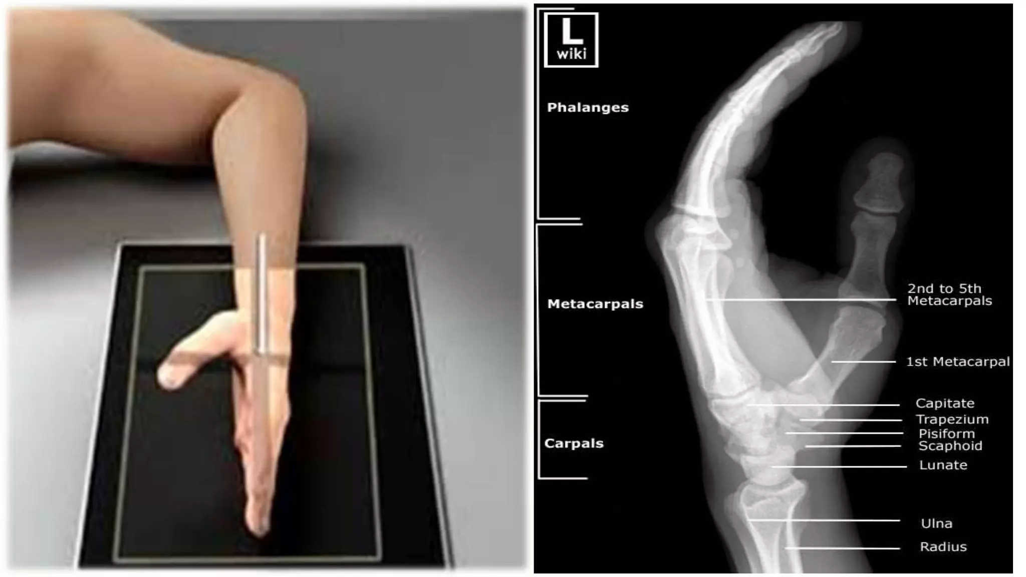 Basic and supplementary projection of hand | PPTX