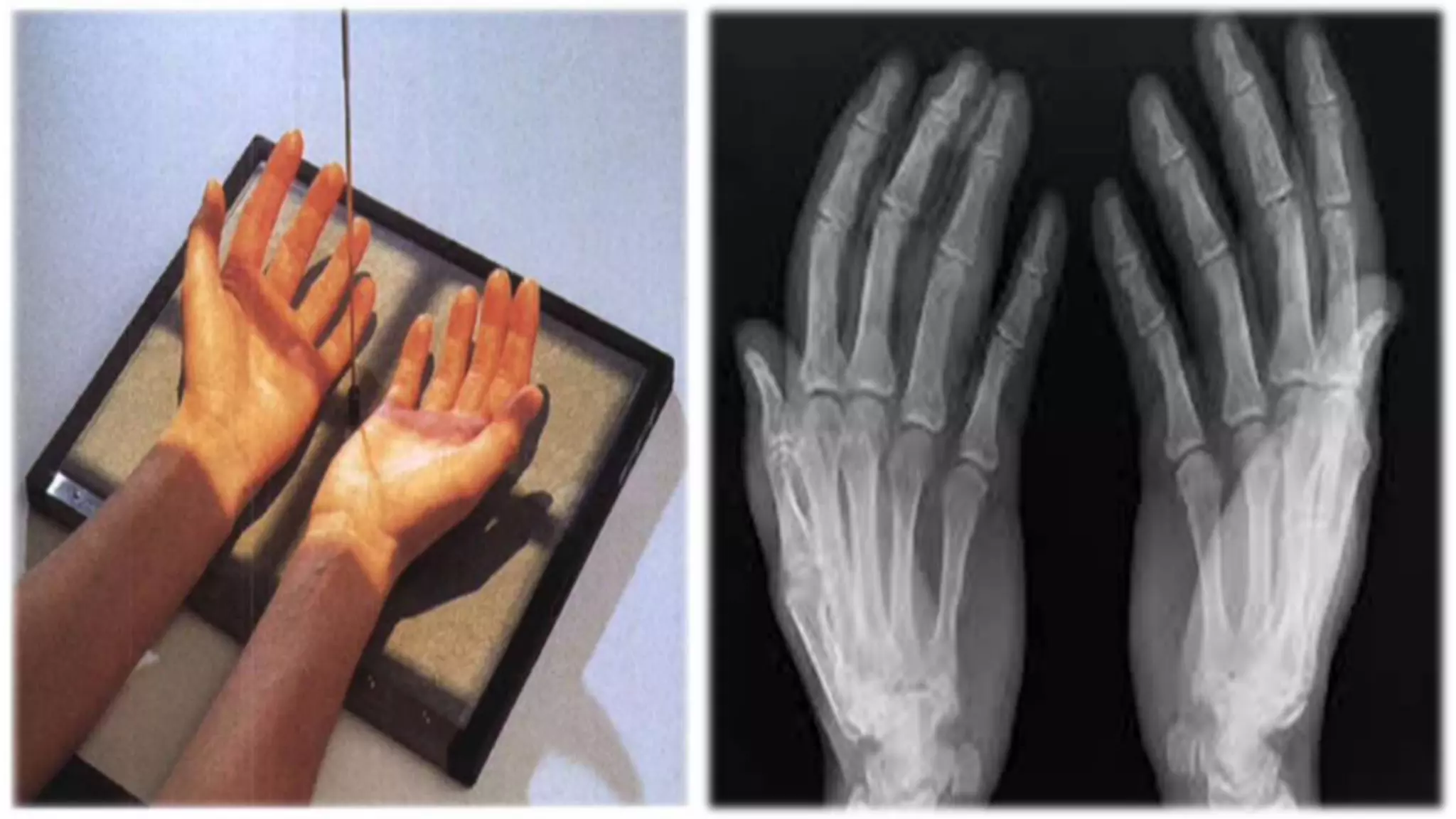 Basic and supplementary projection of hand | PPTX