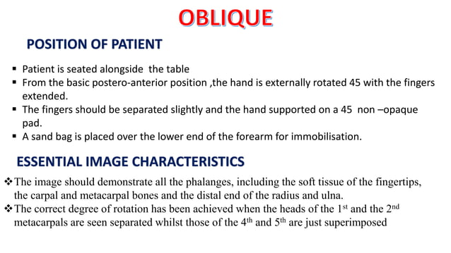 Basic and supplementary projection of hand | PPTX | Death, Injury, or ...