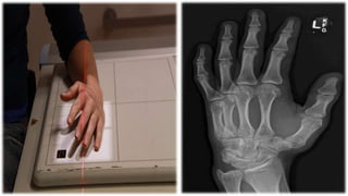 Basic and supplementary projection of hand | PPTX