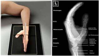 Basic and supplementary projection of hand | PPTX