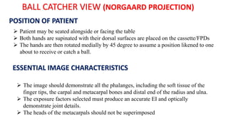 Basic and supplementary projection of hand | PPTX