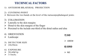 Basic and supplementary projection of hand | PPTX