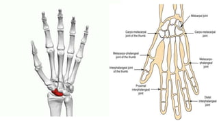 Basic and supplementary projection of hand | PPTX