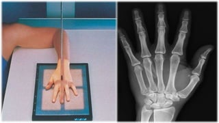 Basic and supplementary projection of hand | PPTX