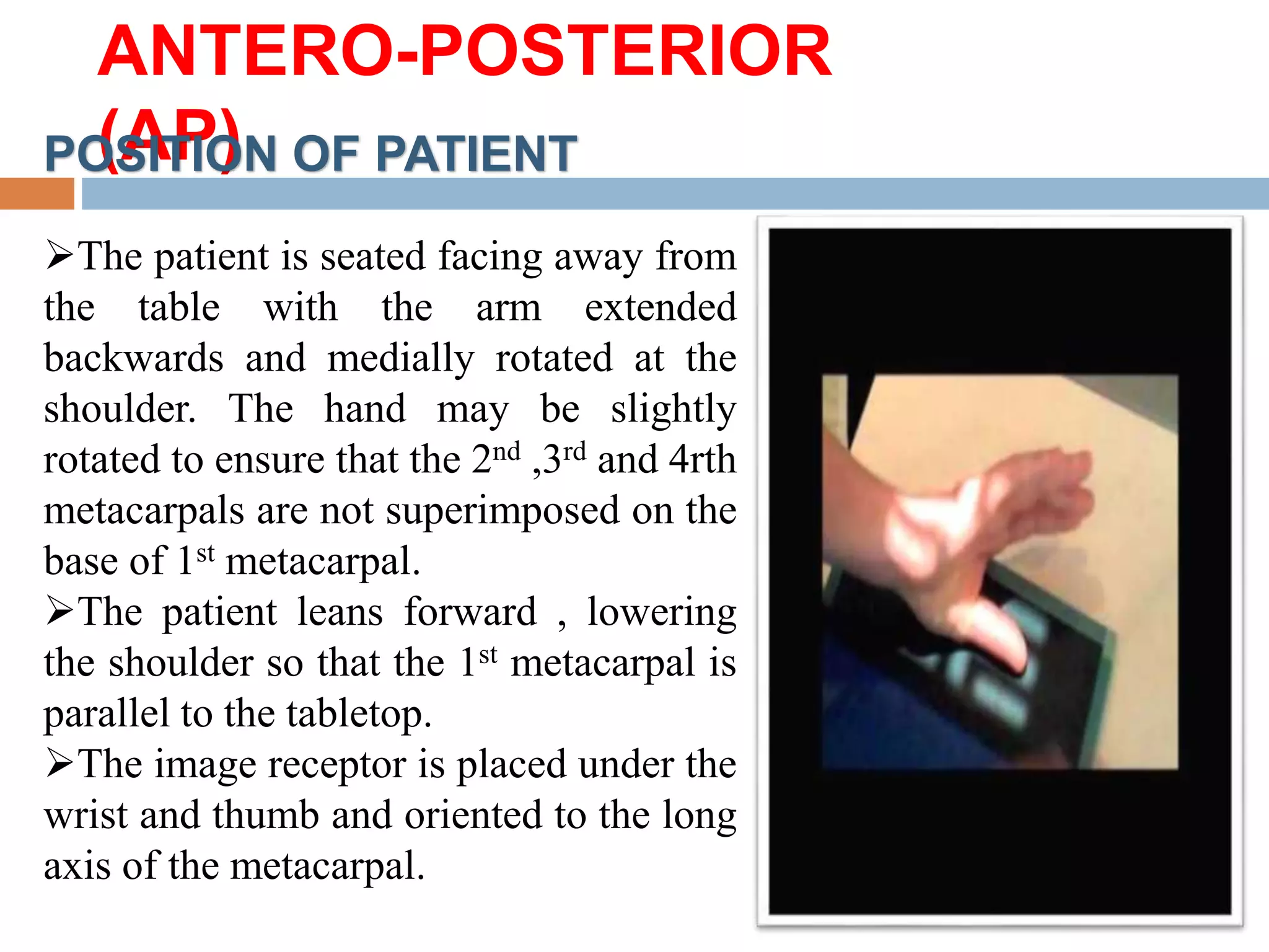Basic and supplementary projections of thumb and scaphoid | PPTX