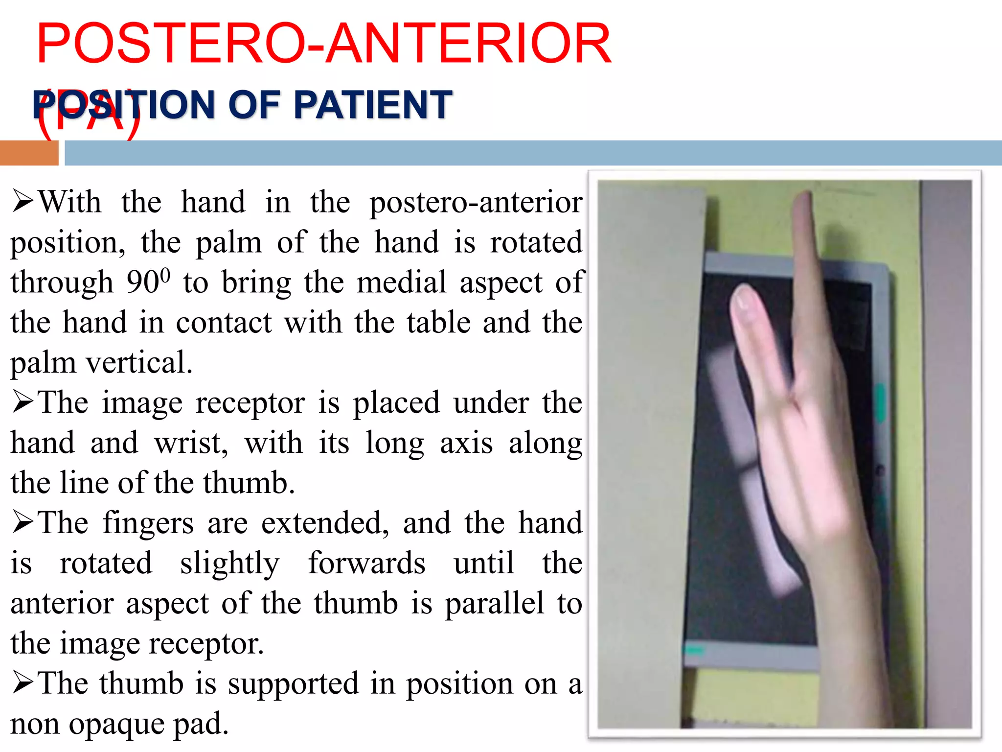 Basic and supplementary projections of thumb and scaphoid | PPTX