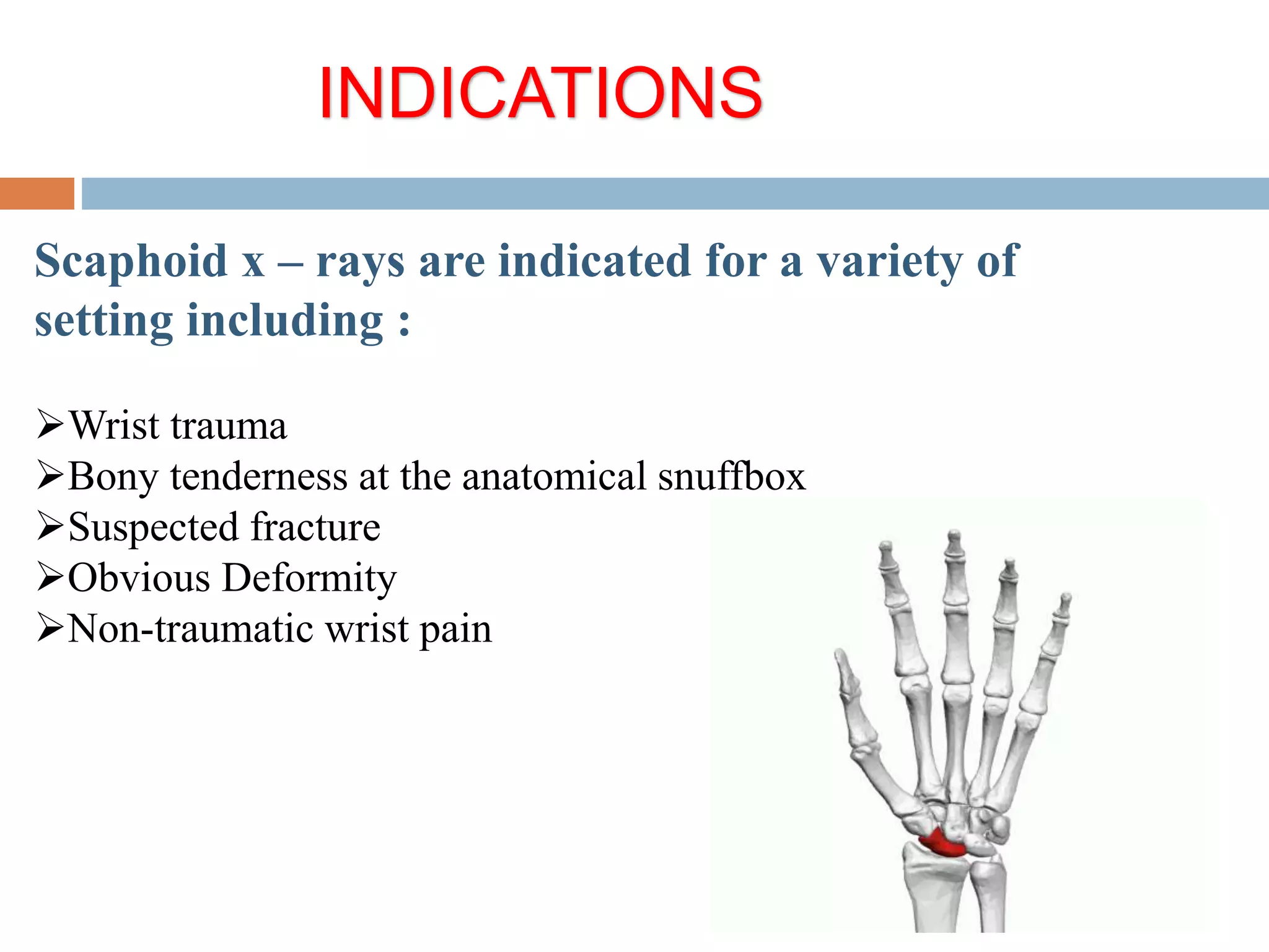 Basic and supplementary projections of thumb and scaphoid | PPTX