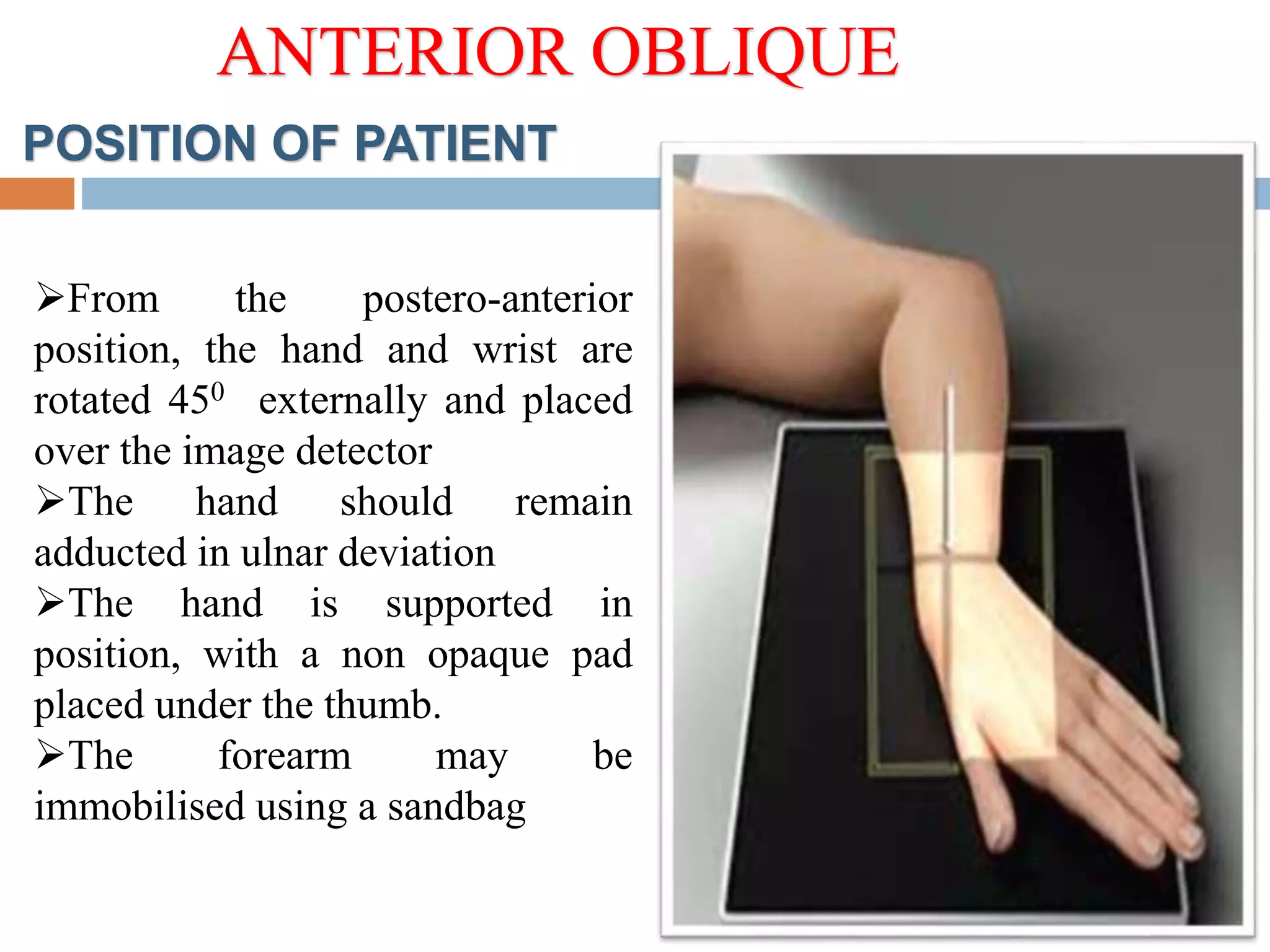 Basic and supplementary projections of thumb and scaphoid | PPTX