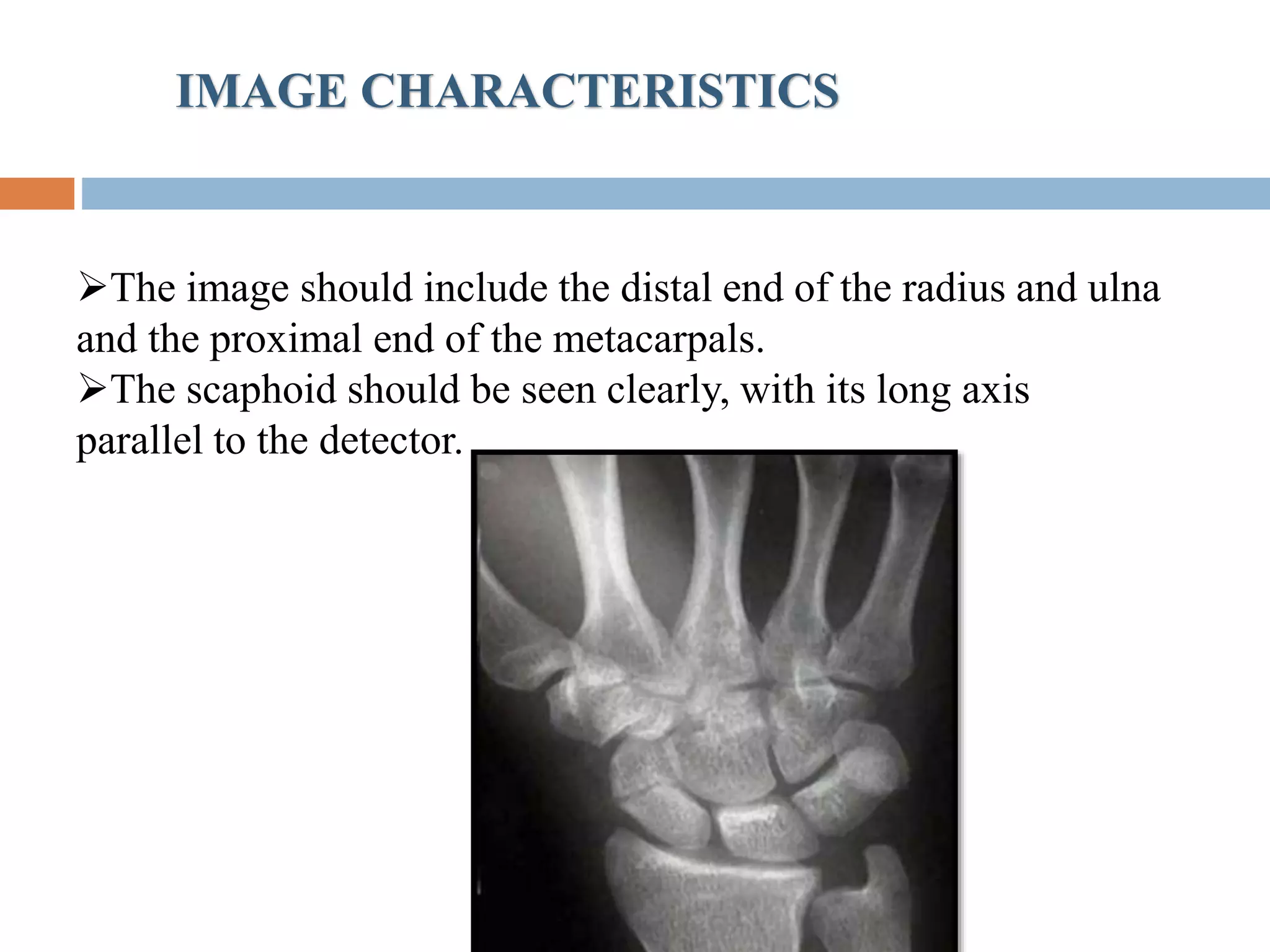 Basic and supplementary projections of thumb and scaphoid | PPTX