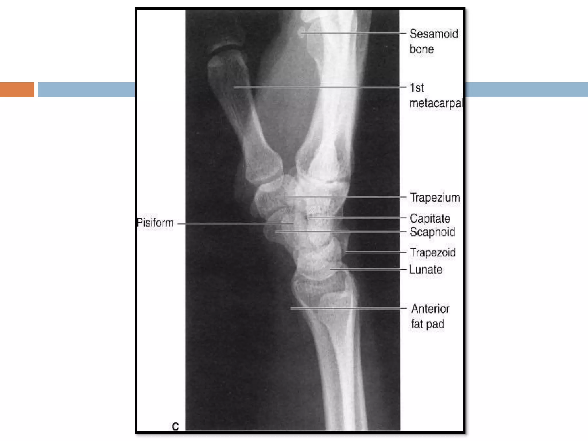 Basic and supplementary projections of thumb and scaphoid | PPTX