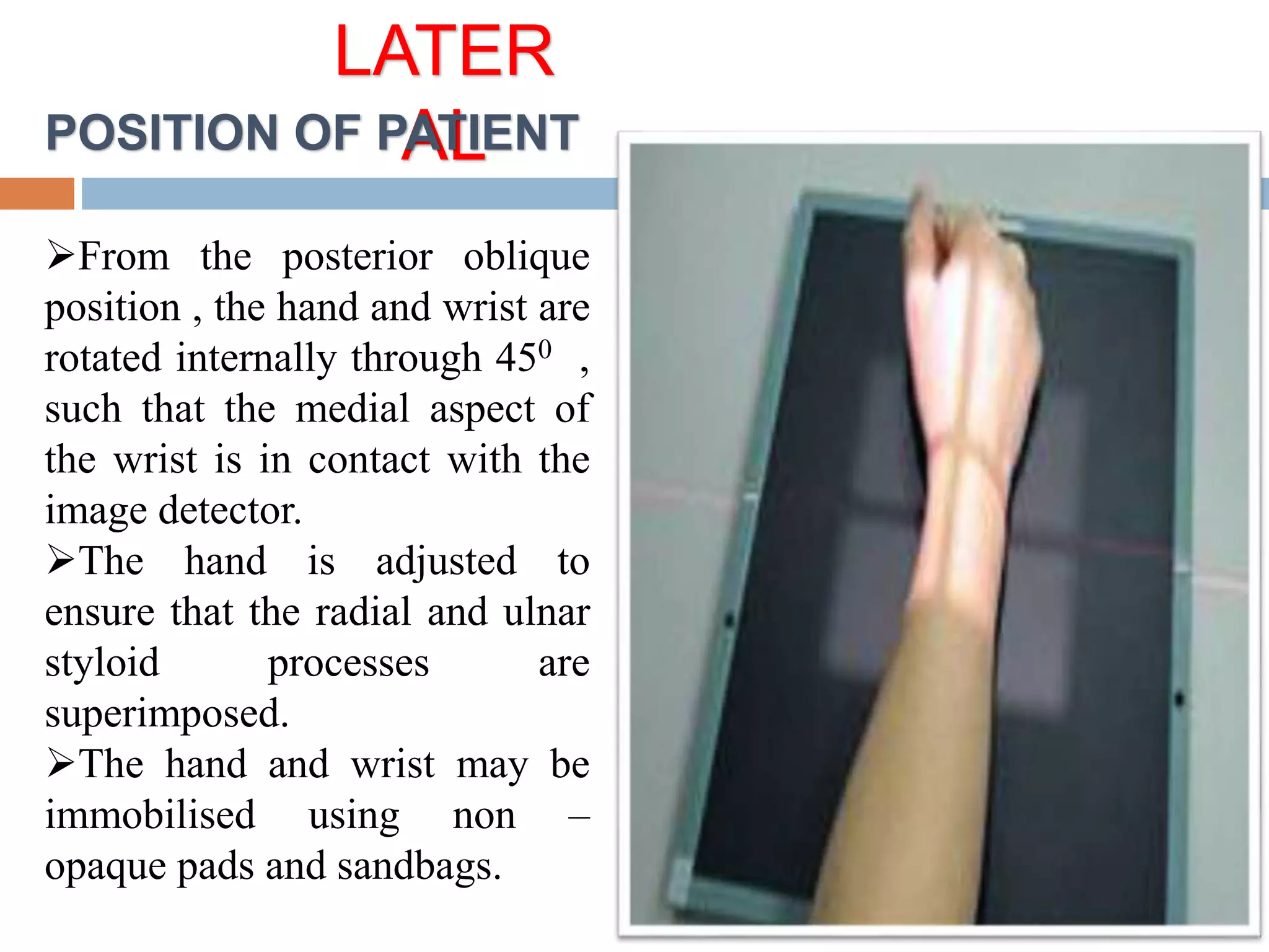 Basic and supplementary projections of thumb and scaphoid | PPTX