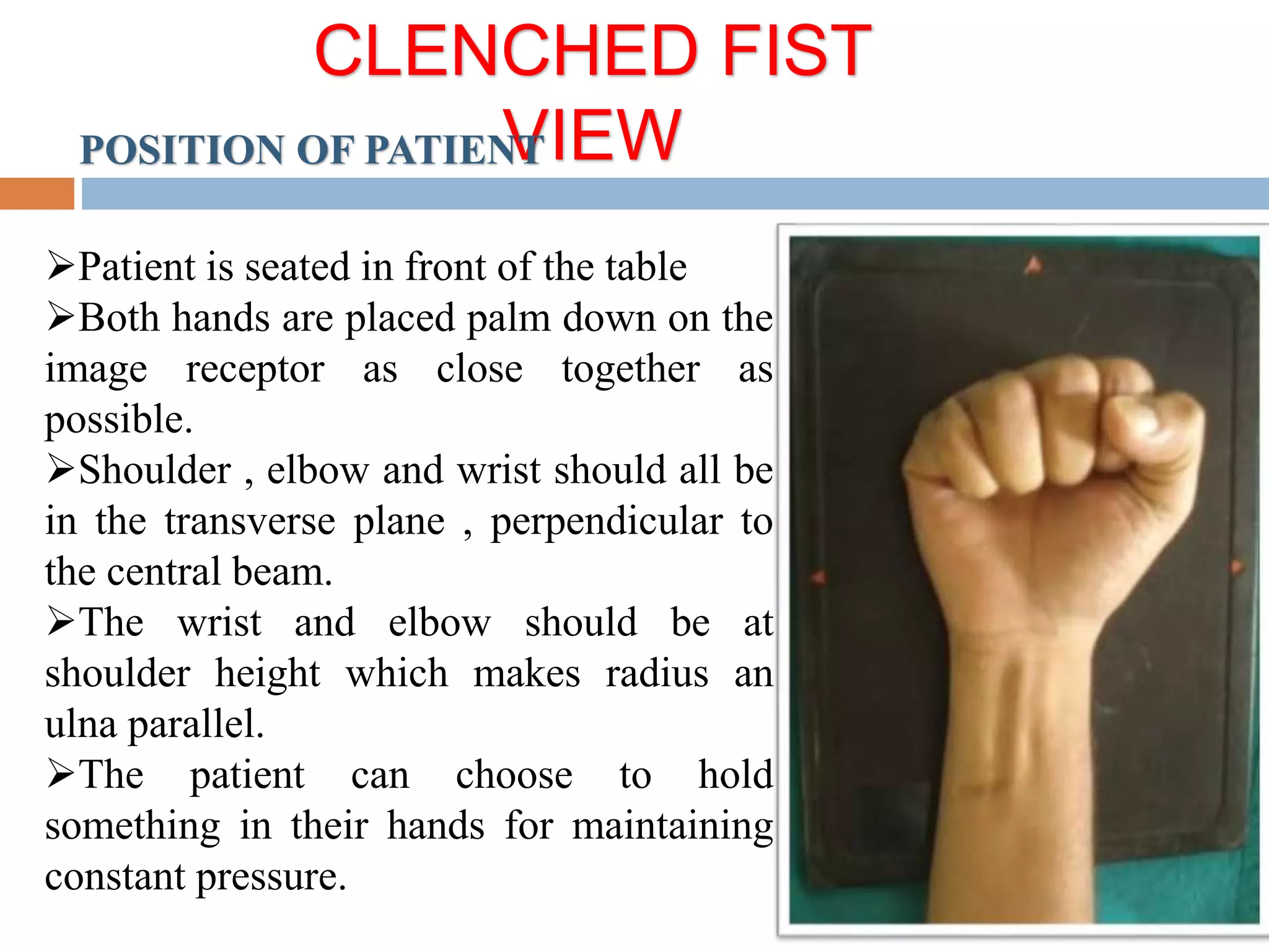 Basic and supplementary projections of thumb and scaphoid | PPTX