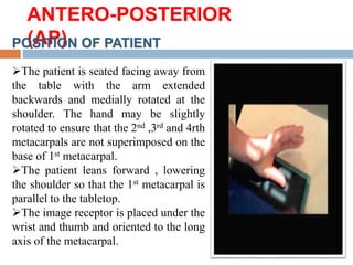 Basic and supplementary projections of thumb and scaphoid | PPTX