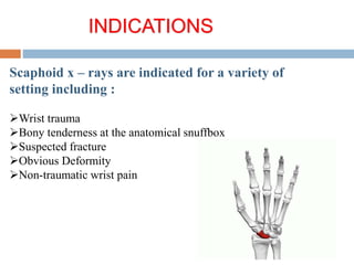 Basic and supplementary projections of thumb and scaphoid | PPTX