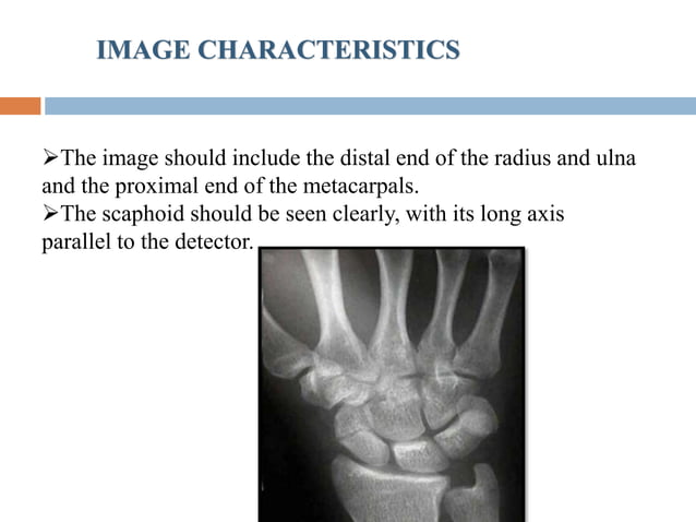 Basic and supplementary projections of thumb and scaphoid | PPTX