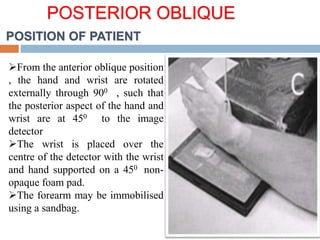 Basic and supplementary projections of thumb and scaphoid | PPTX