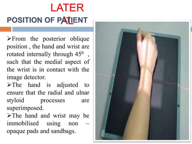 Basic and supplementary projections of thumb and scaphoid | PPTX