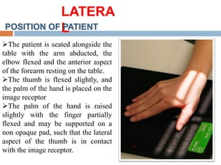 Basic and supplementary projections of thumb and scaphoid | PPTX