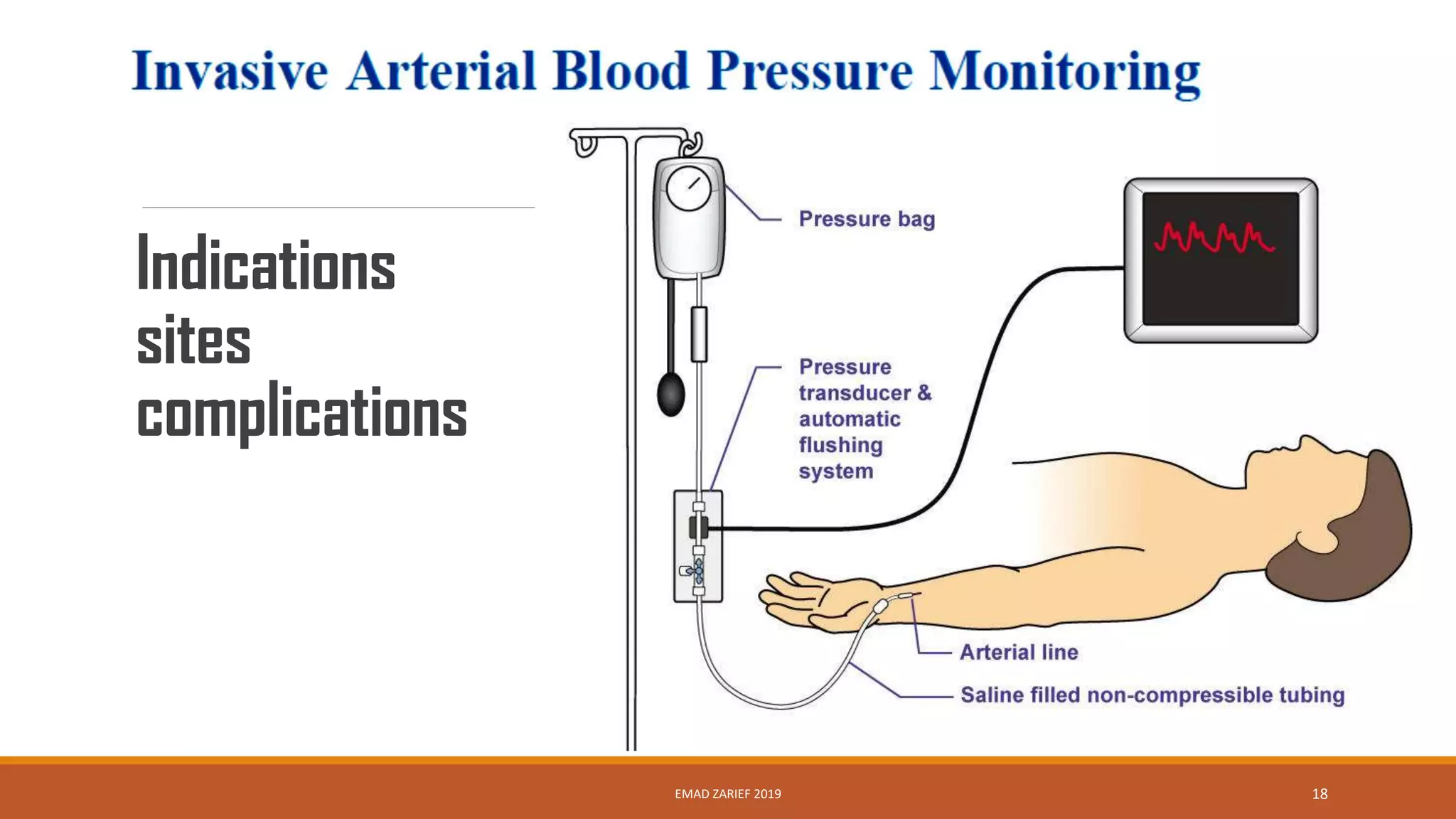 Basic anesthesia monitoring- Emad Zarief | PDF