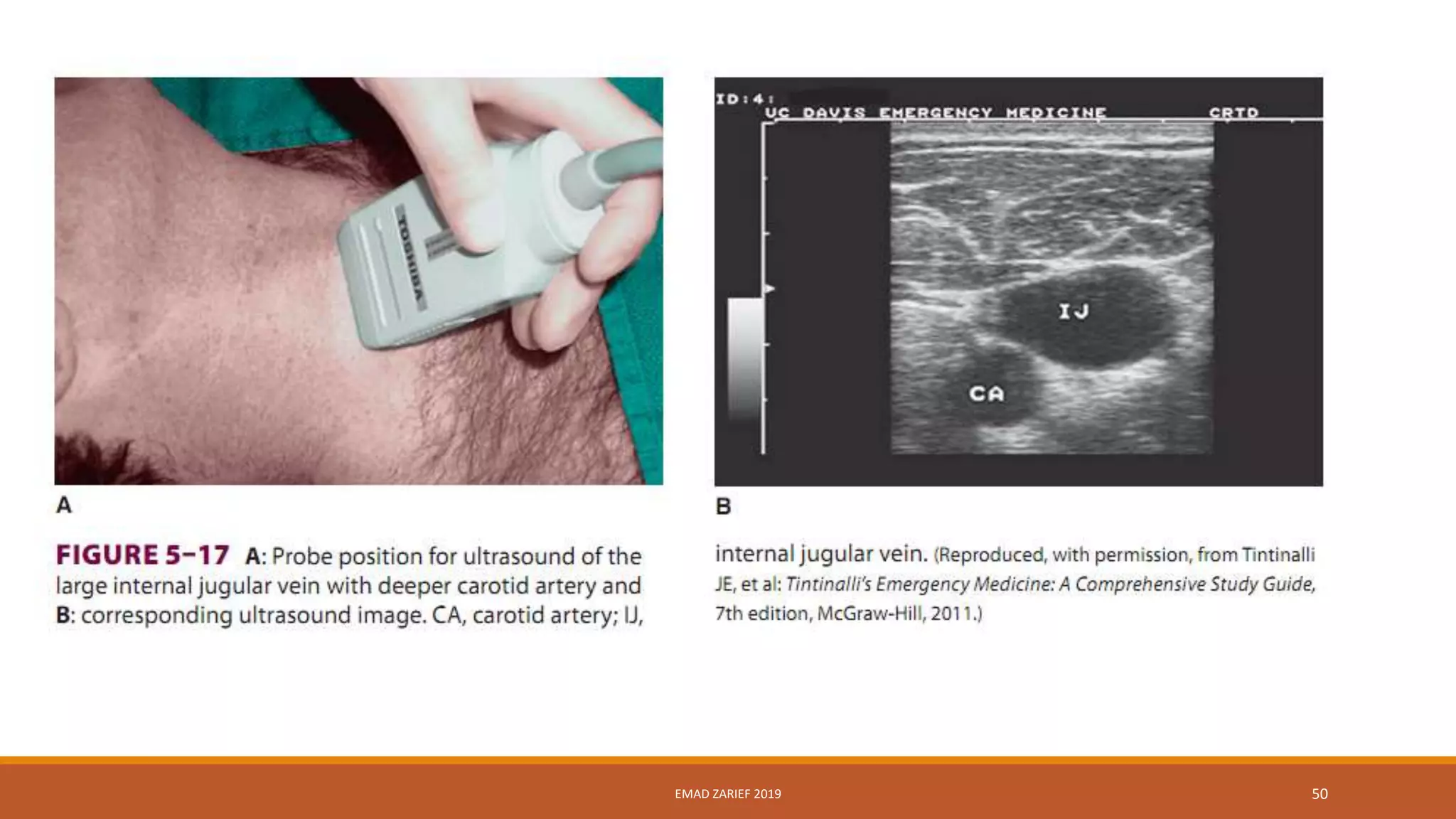 Basic anesthesia monitoring- Emad Zarief | PDF