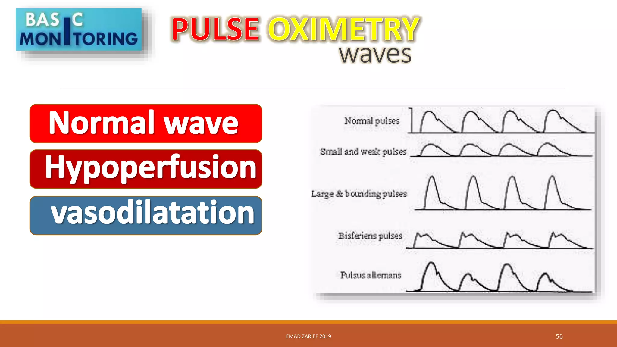Basic anesthesia monitoring- Emad Zarief | PDF