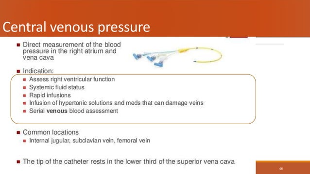 Basic anesthesia monitoring- Emad Zarief | PPT