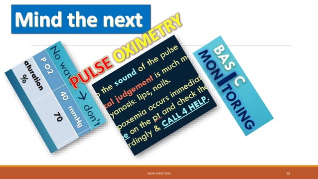 Basic anesthesia monitoring- Emad Zarief | PPT