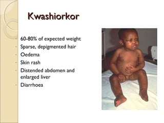 Basic anthropometry ppt. | PPT