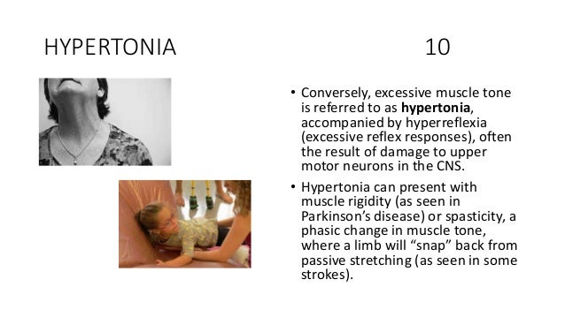 B asic ap chapter 10 powerpoint 2017