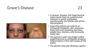 Basic ap chapter 17 powerpoint 2017 | PPTX | Endocrine and Metabolic Diseases | Diseases and ...