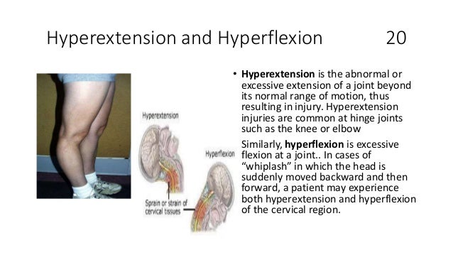 Basic ap chapter 9 powerpoint 2017